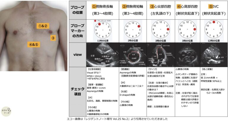 急性心不全の初期対応と治療｜Nohria-Stevenson分類を攻略 | 医学のすゝめ